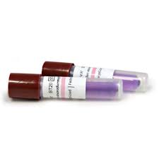 Spore Test Bionova Steam Biological Indicators 24 Hours, 100/Box #BT-20 ...