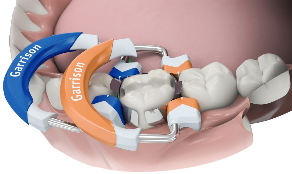 Garrison Ring Composi Tight 3D Fusion Matrix Rings 2/Pack (FX400-FX500 ...