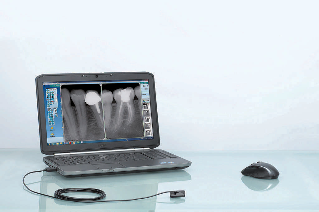 Owandy- OPTEO IntraOral Digital XRay Sensor Size #1 – Class I Dental Supply